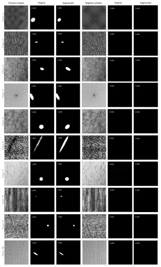 An Attention-Based Network for Textured Surface Anomaly Detection