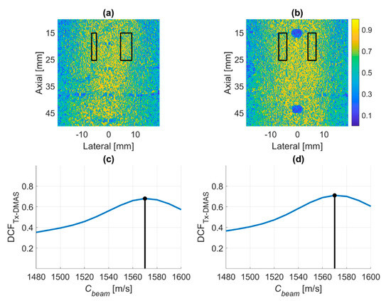 Ultrasound DMAS Beamforming for Estimation of Tissue Speed of Sound in ...