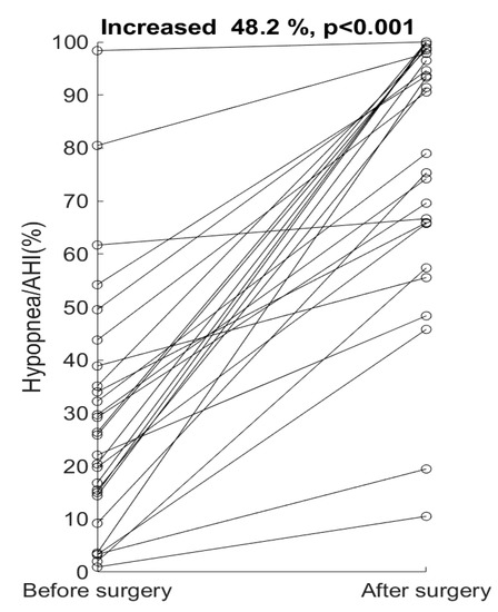Increasing Hypopnea in Sleep Breathing Disturbance Improves ...
