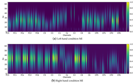 A Discriminative Multi-Output Gaussian Processes Scheme for Brain Electrical Activity Analysis