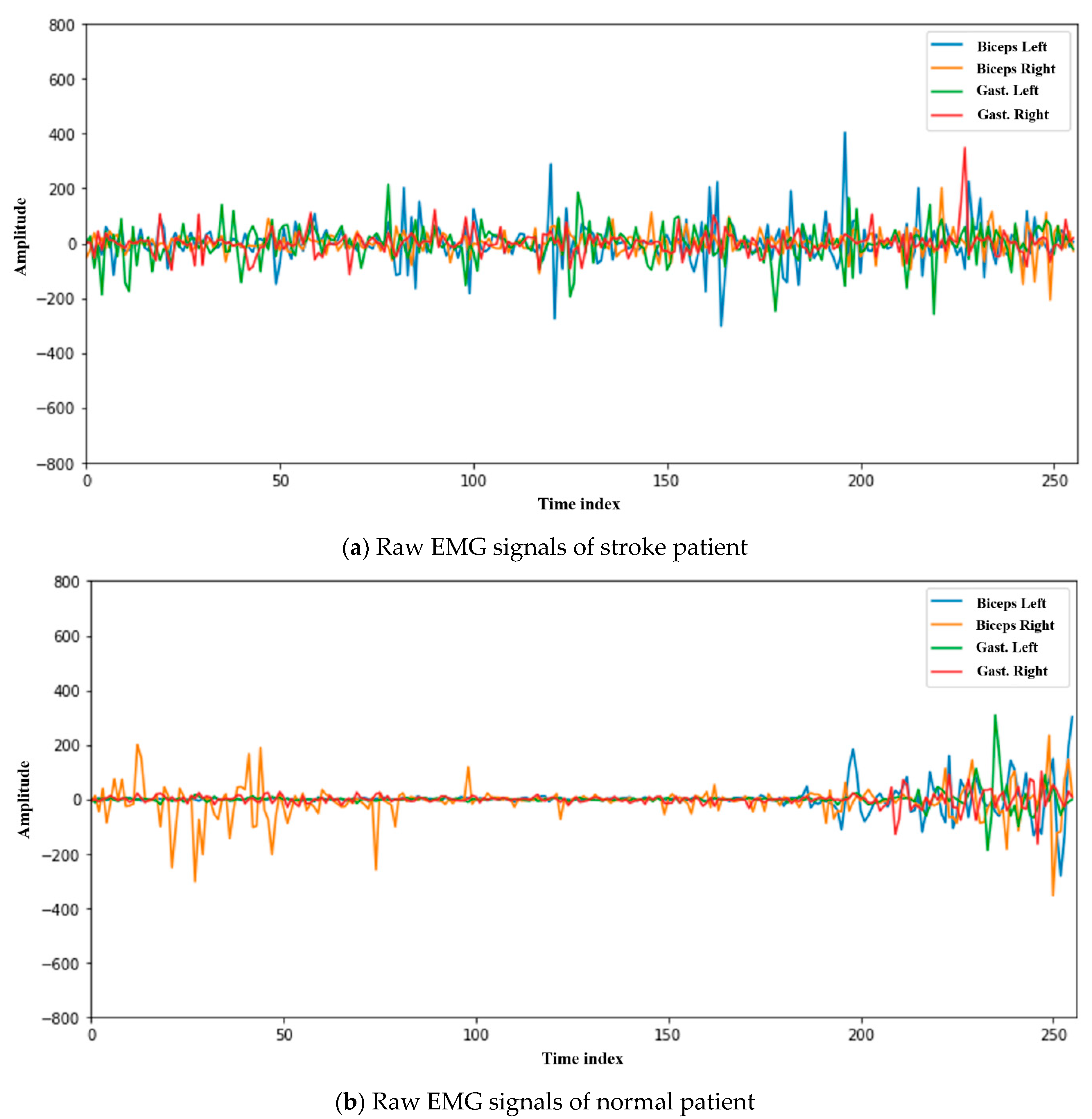 AI-Based Stroke Disease Prediction System Using Real-Time Electromyography Signals