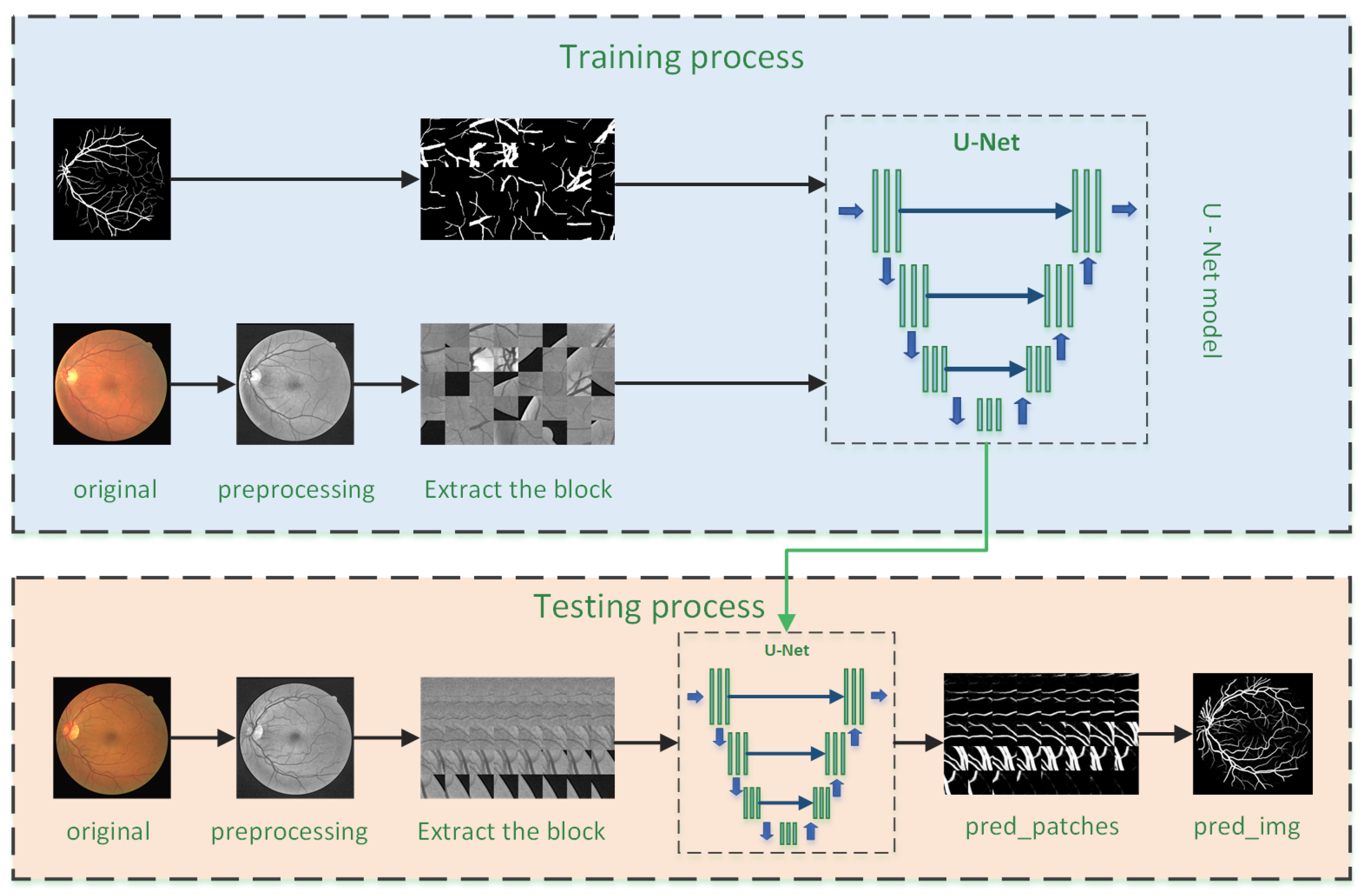 MRU-NET: A U-Shaped Network for Retinal Vessel Segmentation