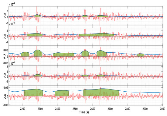 Automatic Contraction Detection Using Uterine Electromyography