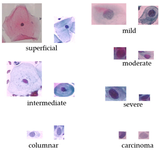 Improving Computer-Aided Cervical Cells Classification Using Transfer ...