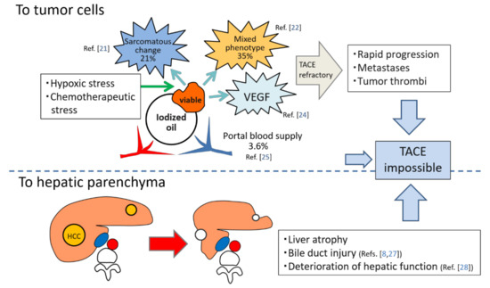Treatment Strategy of Transarterial Chemoembolization for ...