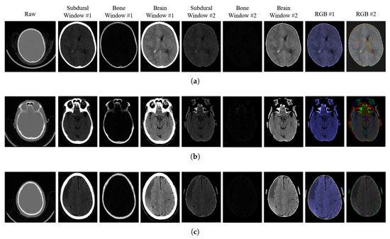 Intracranial Hemorrhage Detection in Head CT Using Double-Branch ...