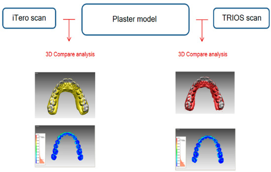 Digital Intraoral Scanners and Alginate Impressions in Reproducing Full ...