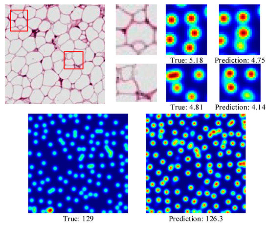 A Cell Counting Framework Based on Random Forest and Density Map
