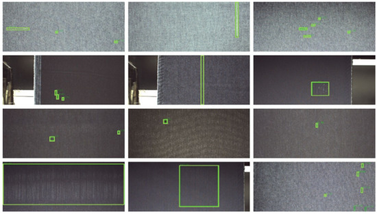 Automatic Fabric Defect Detection Method Using PRAN-Net