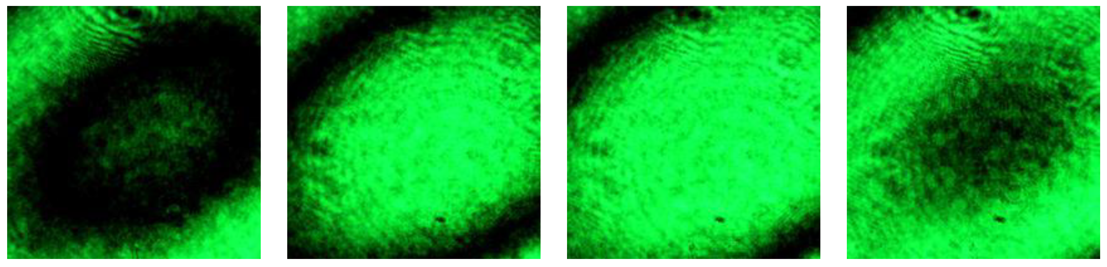 Interferometric Wavefront Sensing System Based on Deep Learning