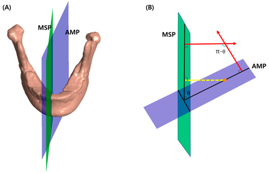 A New Approach to Set the Absolute Midsagittal Plane of the Mandible ...