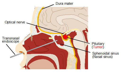 Multilayered Artificial Dura-Mater Models for a Minimally Invasive ...