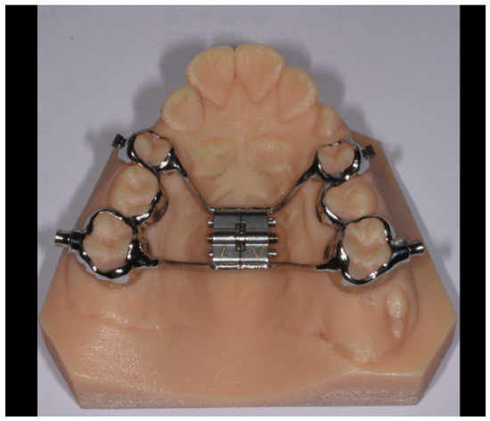 Association between Rapid Maxillary Expansion and Nocturnal Enuresis in ...