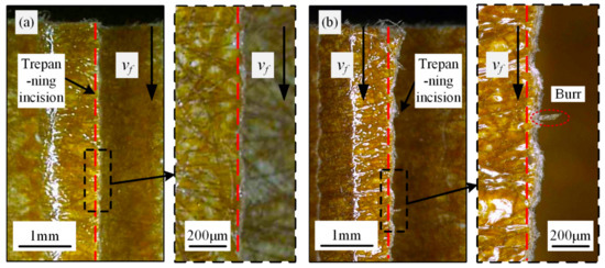 Applied Sciences | Free Full-Text | A Novel Ultrasonic Trepanning ...