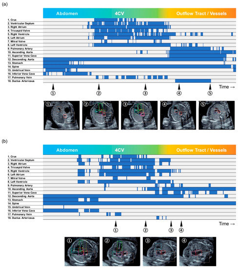 Detection of Cardiac Structural Abnormalities in Fetal Ultrasound ...