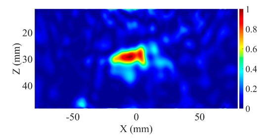 Experimental Validation on Tissue-Mimicking Phantoms of Millimeter-Wave ...
