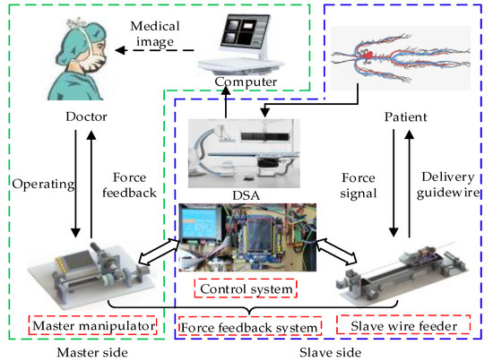 A Novel Vascular Intervention Surgical Robot Based on Force Feedback ...