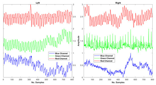 Blood Glucose Level Regression for Smartphone PPG Signals Using Machine ...