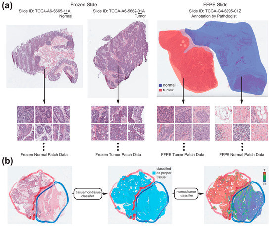 Generalizability of Deep Learning System for the Pathologic Diagnosis ...