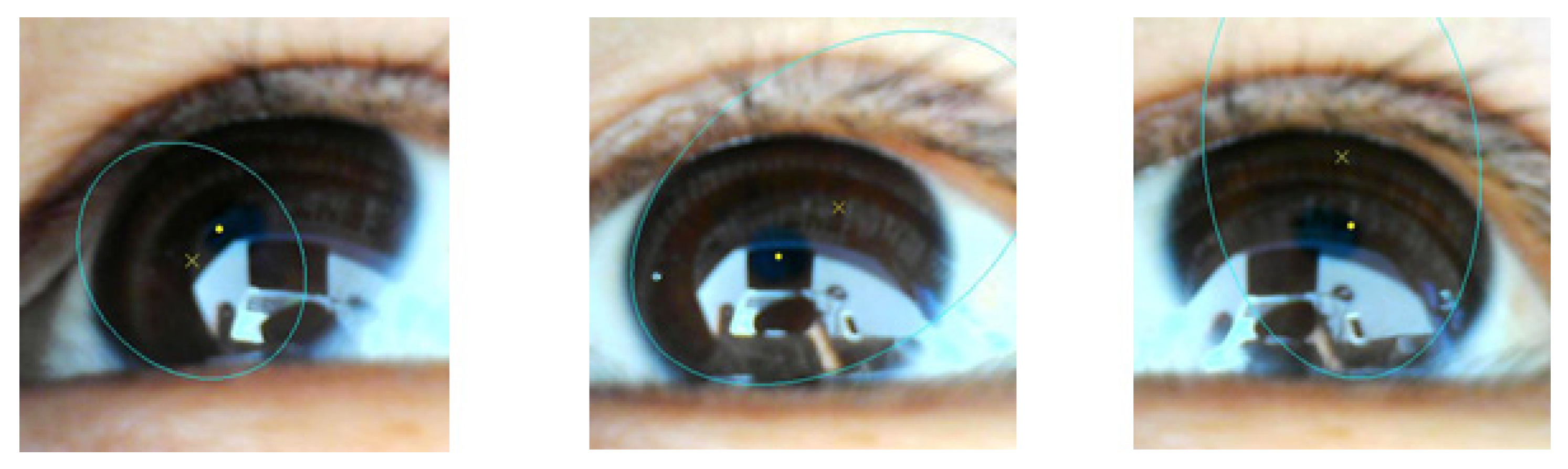 Applied Sciences | Free Full-Text | Deep-Learning-Based Pupil Center ...