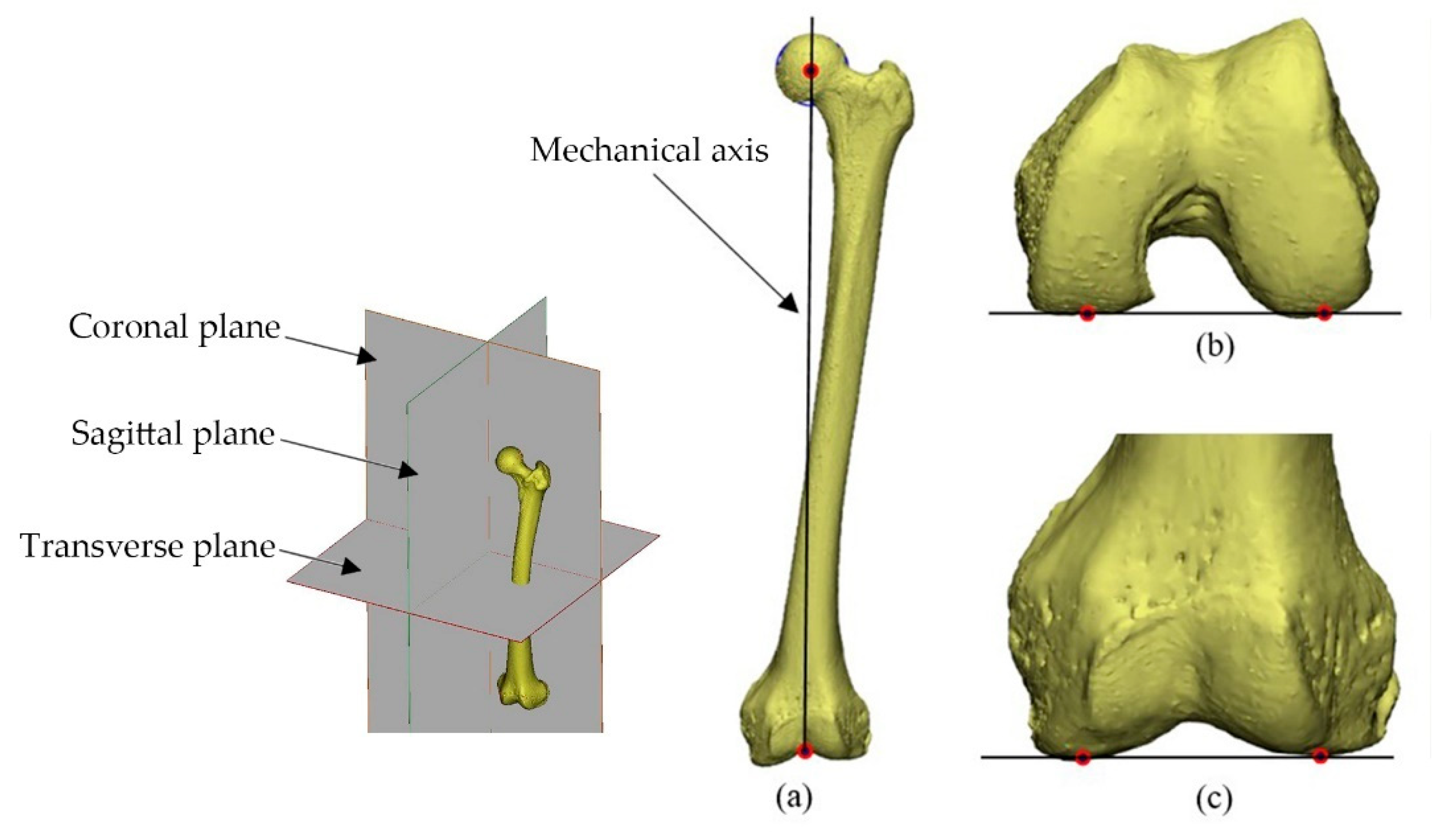 Morphometric Analysis and Three-Dimensional Computed Tomography ...