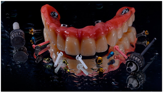 Angled Screwdriver Solutions and Low-Profile Attachments in Full Arch ...