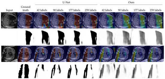 Shadow Estimation for Ultrasound Images Using Auto-Encoding Structures ...