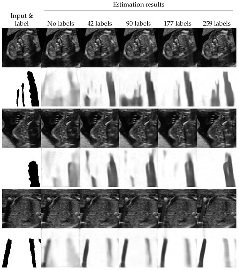 Shadow Estimation for Ultrasound Images Using Auto-Encoding Structures ...