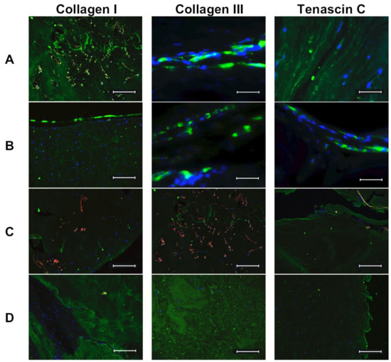 Spider Silk-Augmented Scaffolds and Adipose-Derived Stromal Cells ...