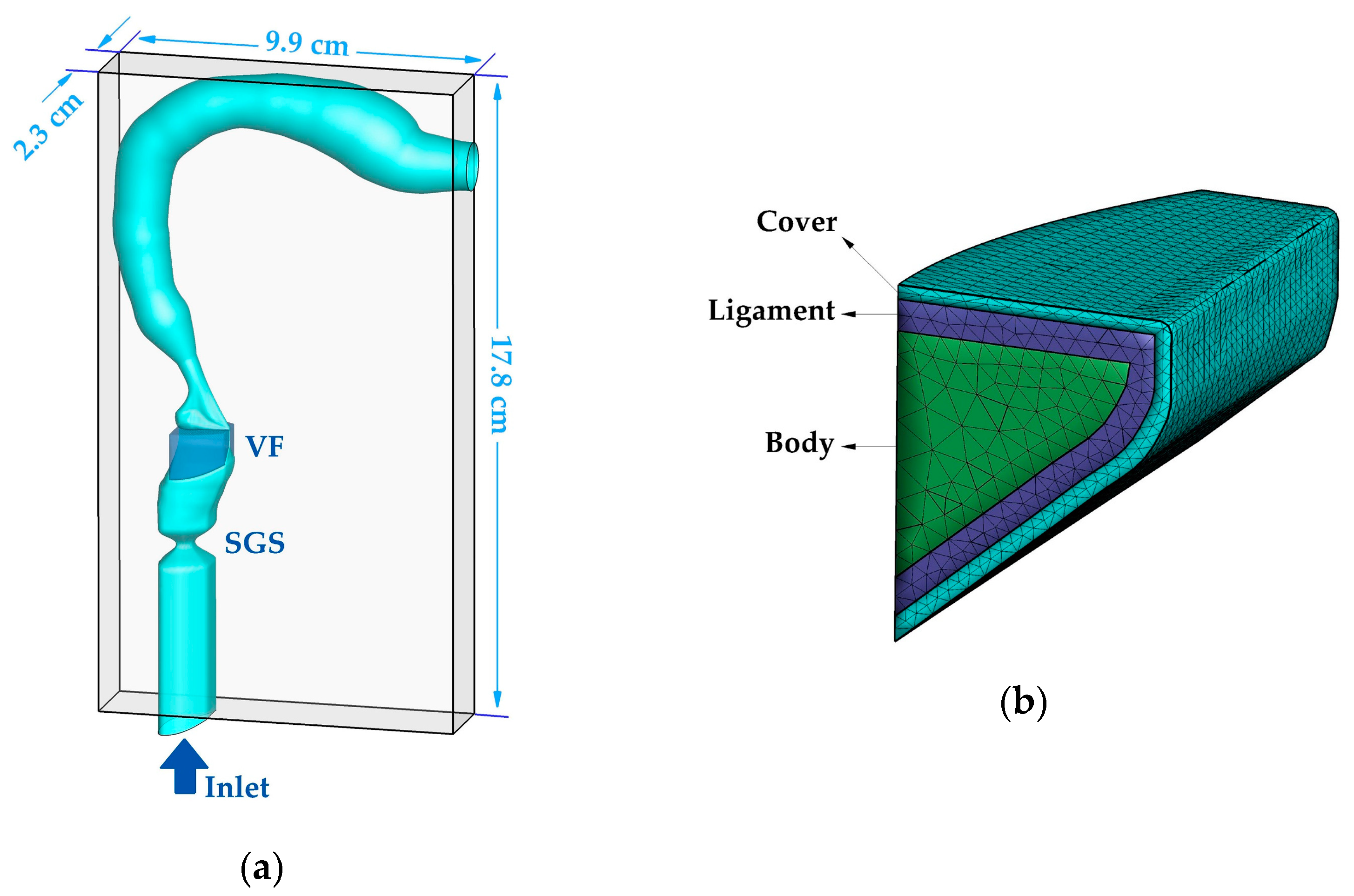 Effect of Subglottic Stenosis on Vocal Fold Vibration and Voice Production Using Fluid–Structure ...