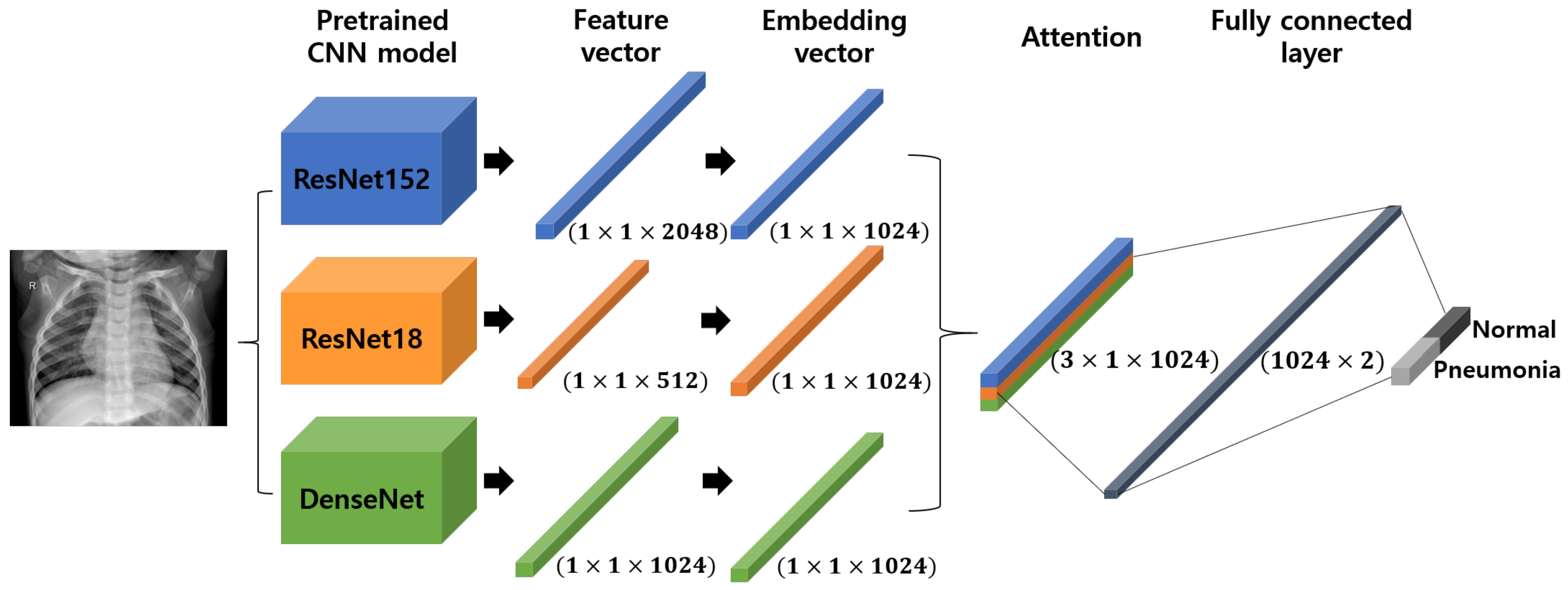 Attention Based Transfer Learning For Efficient Pneumonia Detection In Chest X Ray Images