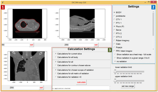 Computer Tools to Analyze Lung CT Changes after Radiotherapy