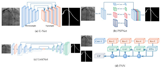 Synthesize and Segment: Towards Improved Catheter Segmentation via Adversarial Augmentation