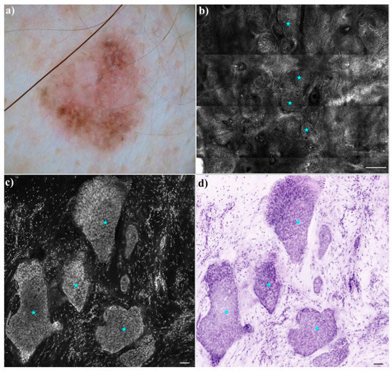 Clinical Applications of In Vivo and Ex Vivo Confocal Microscopy