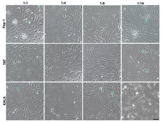 Low Effectiveness of the Introduction of pmaxGFP into Primary Human ...