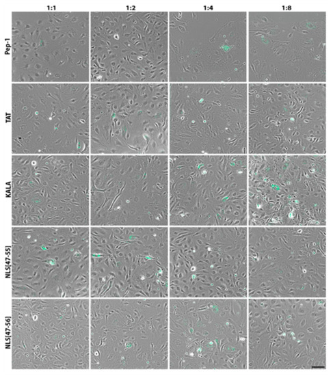 Low Effectiveness of the Introduction of pmaxGFP into Primary Human ...