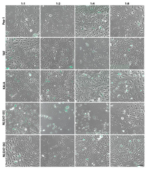 Low Effectiveness of the Introduction of pmaxGFP into Primary Human ...