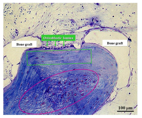 Static Osteogenesis versus Dynamic Osteogenesis: A Comparison between ...