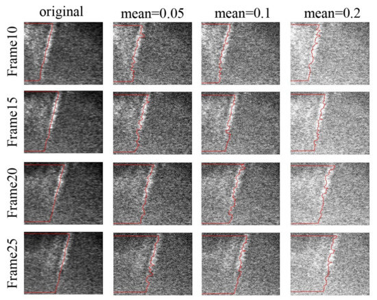 Shear Wave Velocity Estimation Using the Real-Time Curve Tracing Method in Ultrasound Elastography
