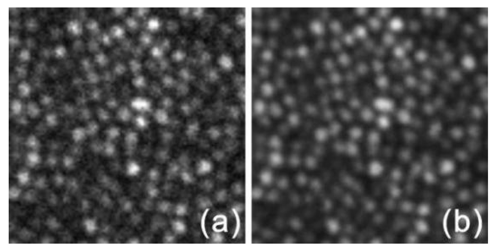 Automated Cone Cell Identification on Adaptive Optics Scanning Laser ...