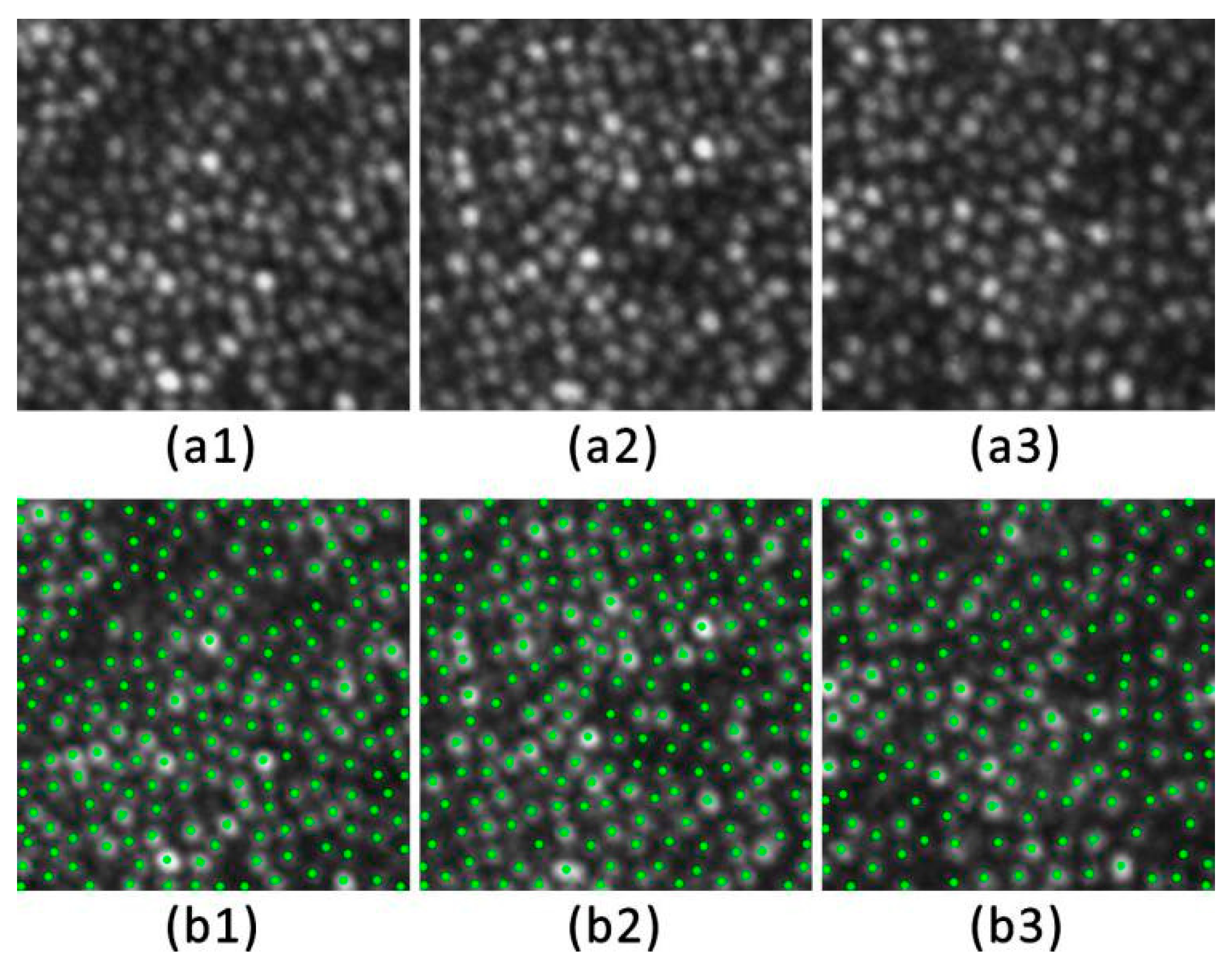 Automated Cone Cell Identification on Adaptive Optics Scanning Laser ...