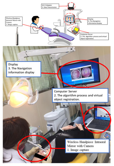 Prototype of Augmented Reality Technology for Orthodontic Bracket ...