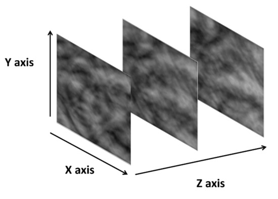 3D Texture Feature Extraction and Classification Using GLCM and LBP ...