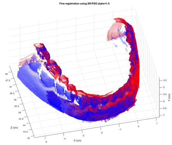 Three-Dimensional Tooth Model Reconstruction Using Statistical ...