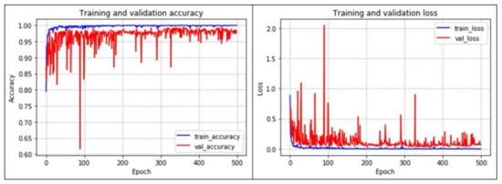 An Improved VGG19 Transfer Learning Strip Steel Surface Defect ...