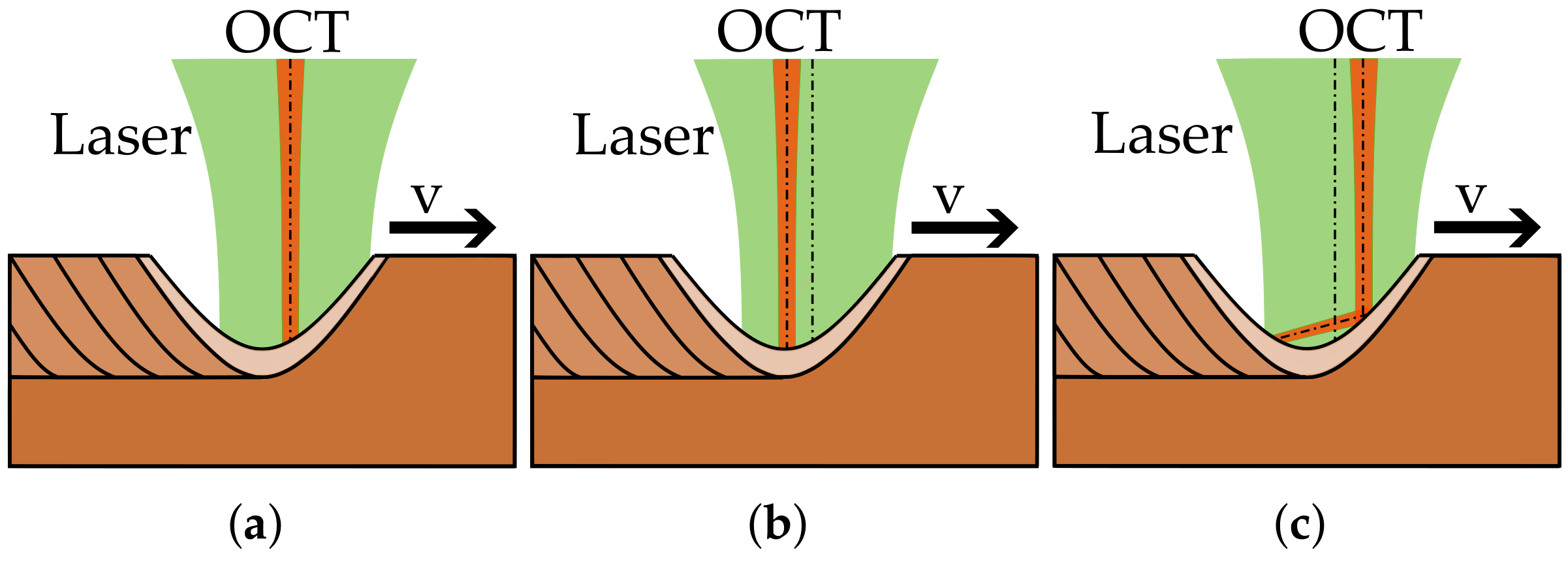 Applied Sciences | Free Full-Text | OCT Capillary Depth Measurement in ...