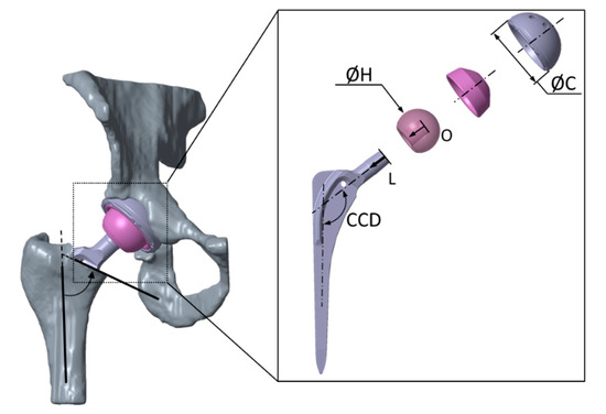 An MRI-Based Patient-Specific Computational Framework for the ...