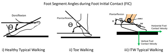 Foot Contact Dynamics and Fall Risk among Children Diagnosed with ...
