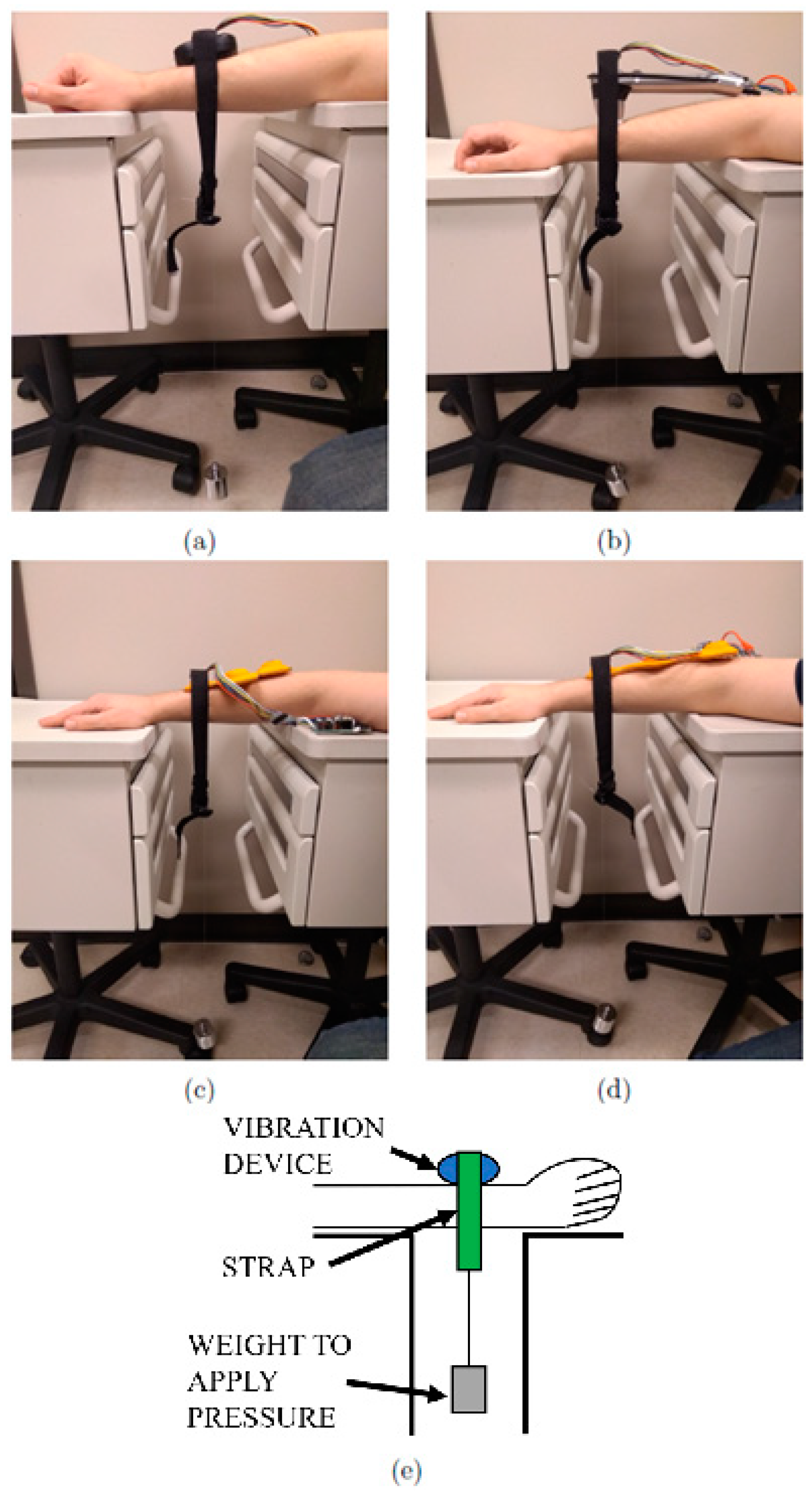 Focal Vibration Therapy: Vibration Parameters of Effective Wearable Devices