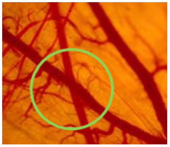 Accurate Simulation of Light Propagation in Complex Skin Tissues Using an Improved Tetrahedron ...